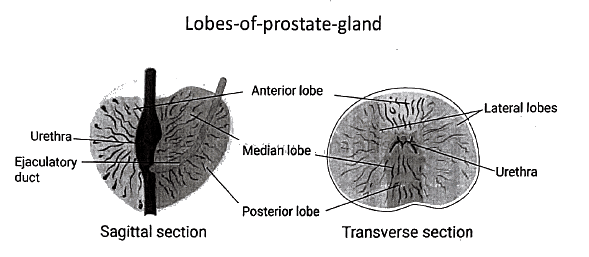 Prostate Gland: Miscellaneous - Medical Science Optional Notes for UPSC ...