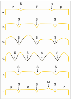 Basic Concepts of Geomorphology - Geology Optional Notes for UPSC PDF ...