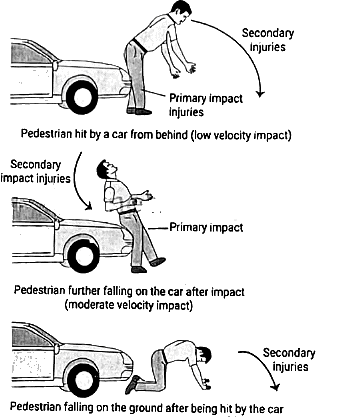 Pedestrian Injuries - Medical Science Optional Notes for UPSC PDF Download