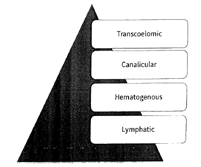 Benign vs Malignant Neoplasm - Medical Science Optional Notes for UPSC ...