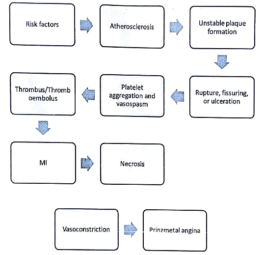 Ischemic Heart Diseas (IHD) - Medical Science Optional Notes for UPSC ...