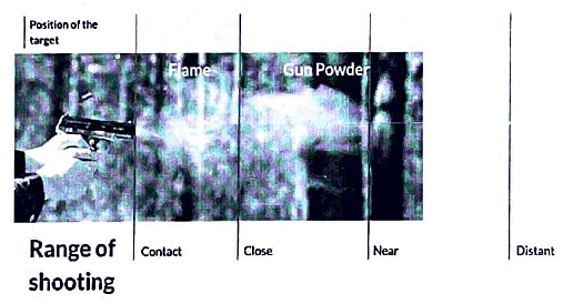 Firearm Entry vs Exit wound - Medical Science Optional Notes for UPSC ...