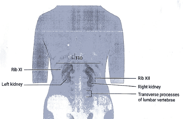 Kidney: Clinical Anatomy - Medical Science Optional Notes for UPSC PDF ...