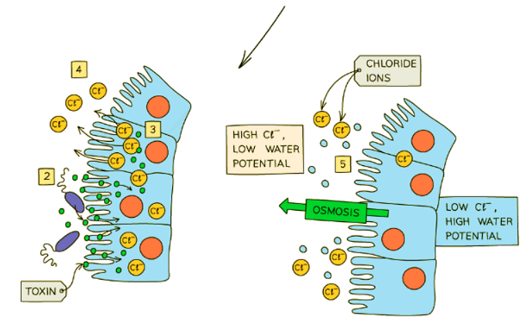Cholera - Biology for GCSE/IGCSE - Year 11 PDF Download