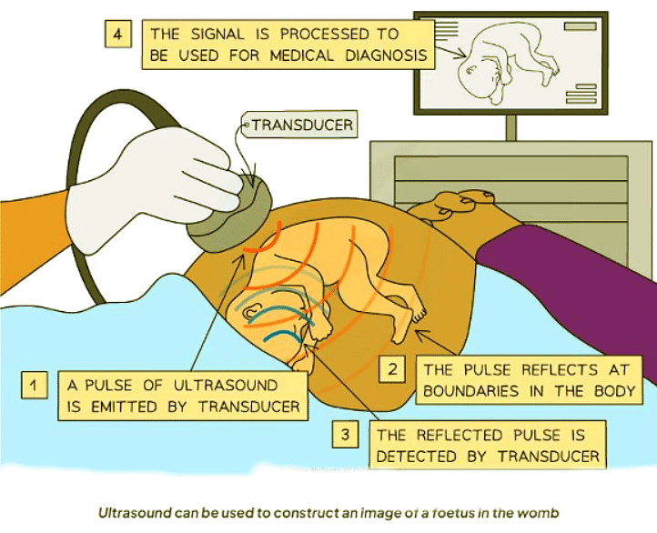 Ultrasound - Physics for GCSE/IGCSE - Year 11 PDF Download
