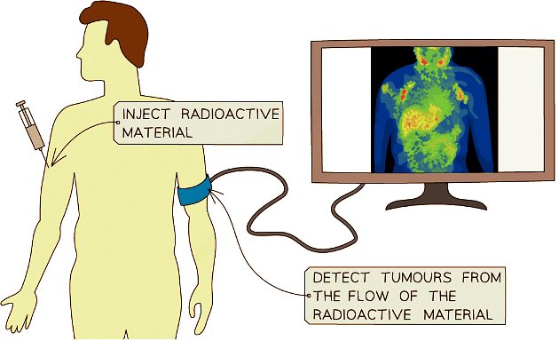 Medical Uses of Radiation - Physics for Grade 10 PDF Download