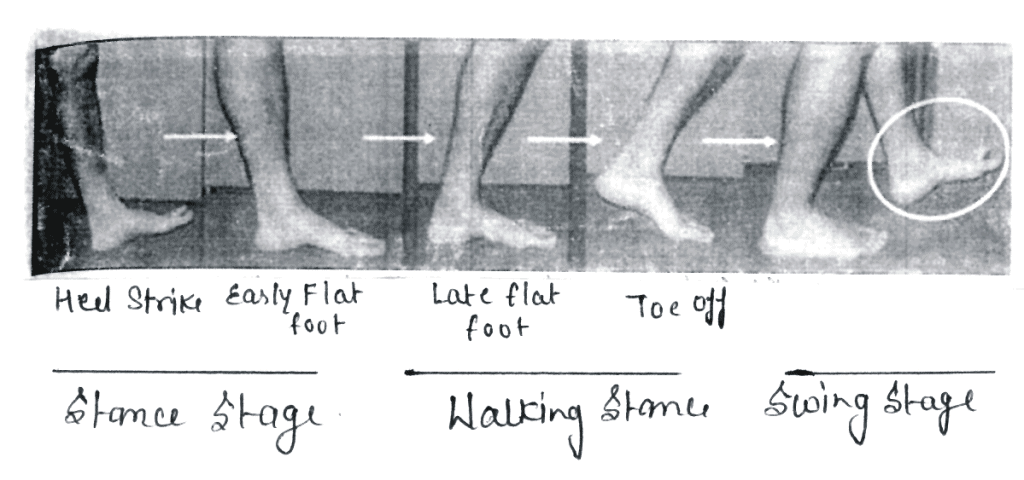 Long Questions With Answers - Biomechanics and Sports - Physical ...