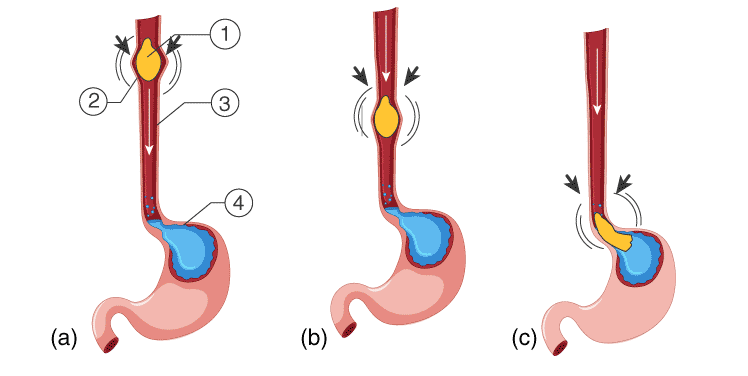 Digestion of Food - Biology Class 11 - NEET PDF Download