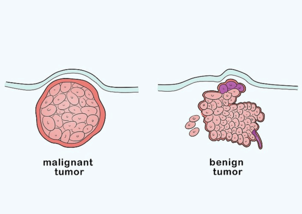 AIDS and Cancer - Biology Class 12 - NEET PDF Download