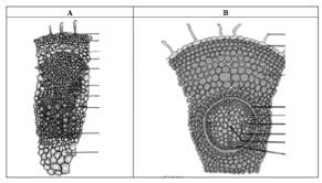 Study the figure and select the correct statementa)A- endarch, B ...